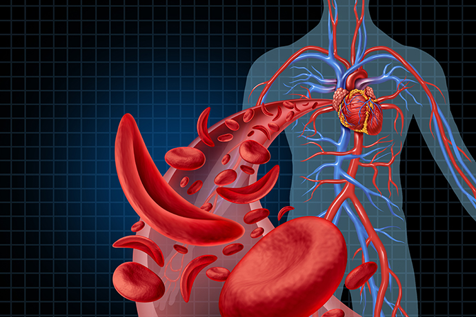 Anemia Bupa Latinoamérica